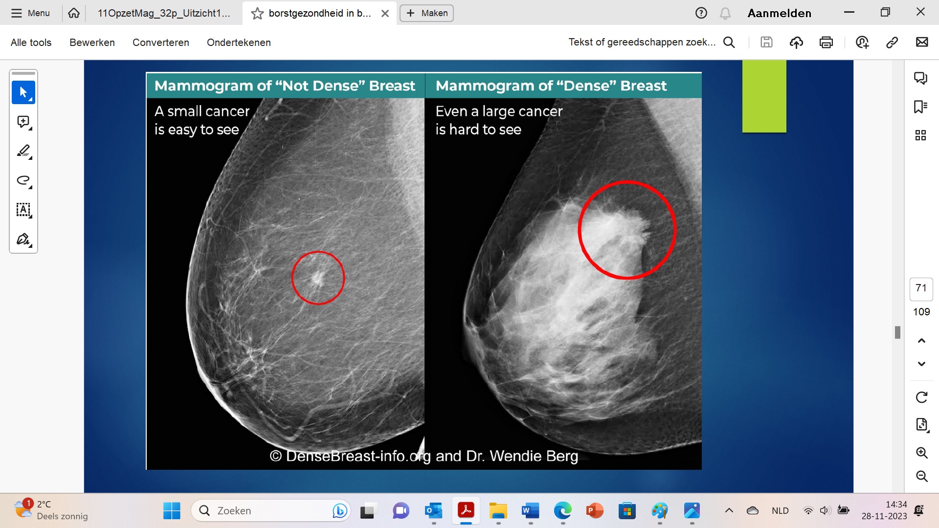 Lezing Femme Zijlstra: 'Hoe dicht is jouw borstweefsel?' | MMV
